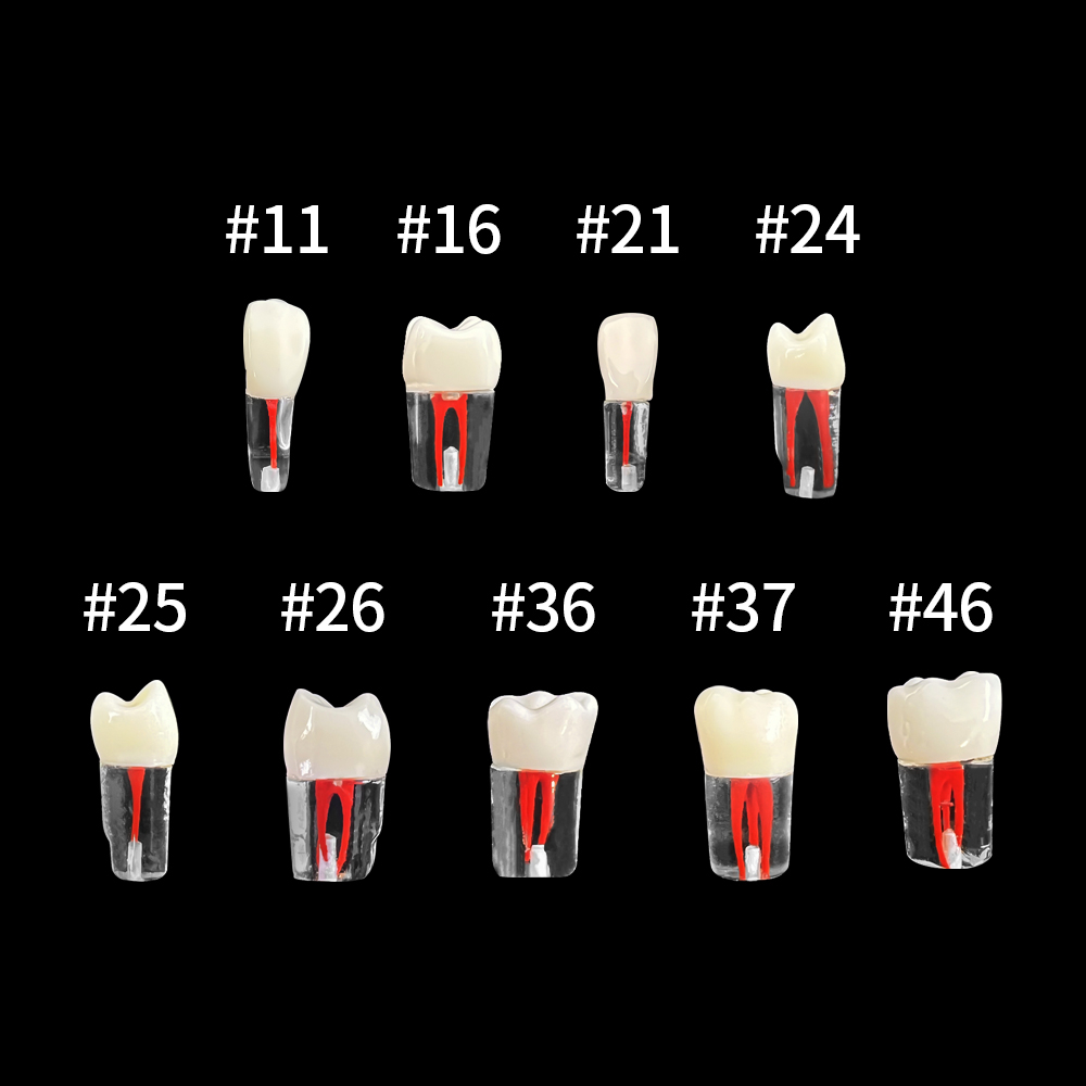 Modelo De Dente Endodôntico De Resina Endo Root Canal Arquivos De Polpa ...