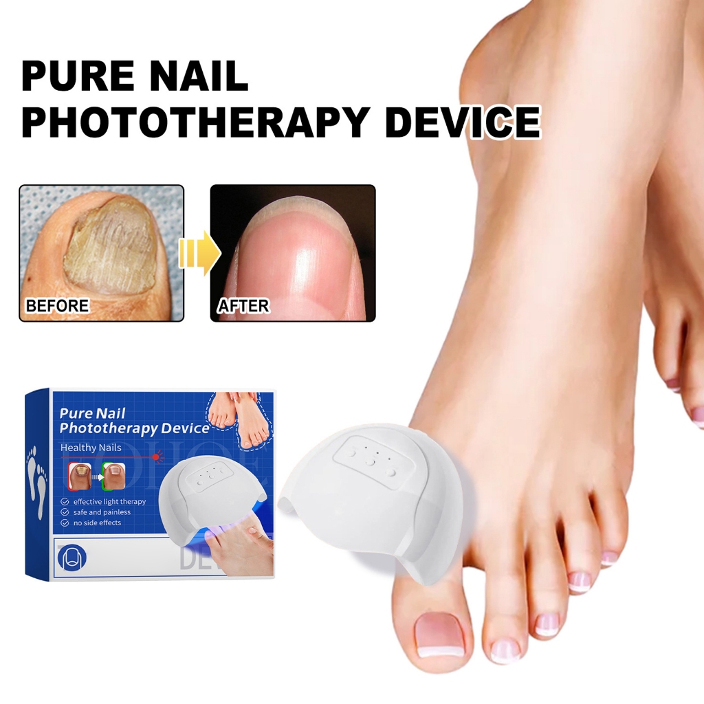 Dispositivo De Terapia A laser De Unhas Cinza , Furzero | Shopee Brasil