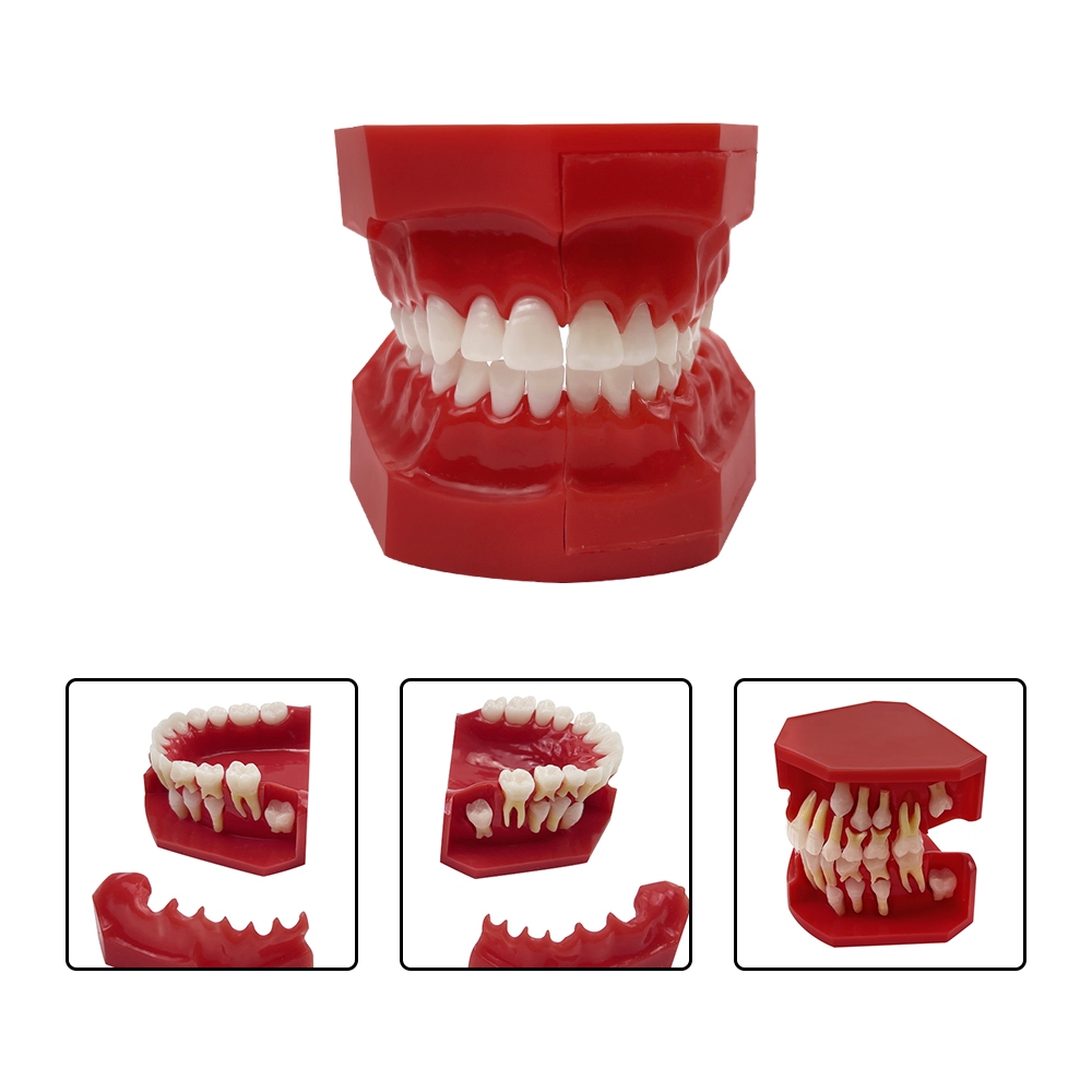 Para Estudar Ensino Demonstração Modelo Dental Resina Crianças De Dente ...