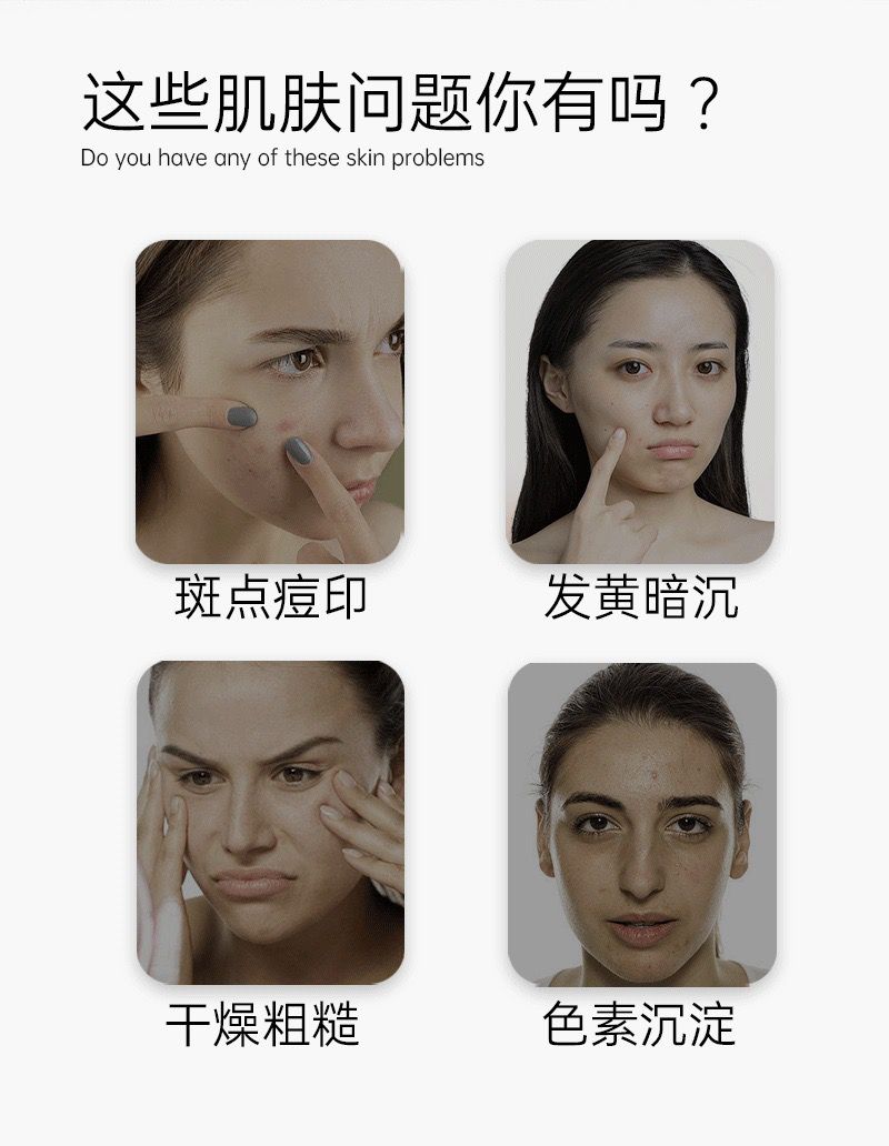 [Preferencial Global] 377 Essência de clareamento Facial amarelado ...