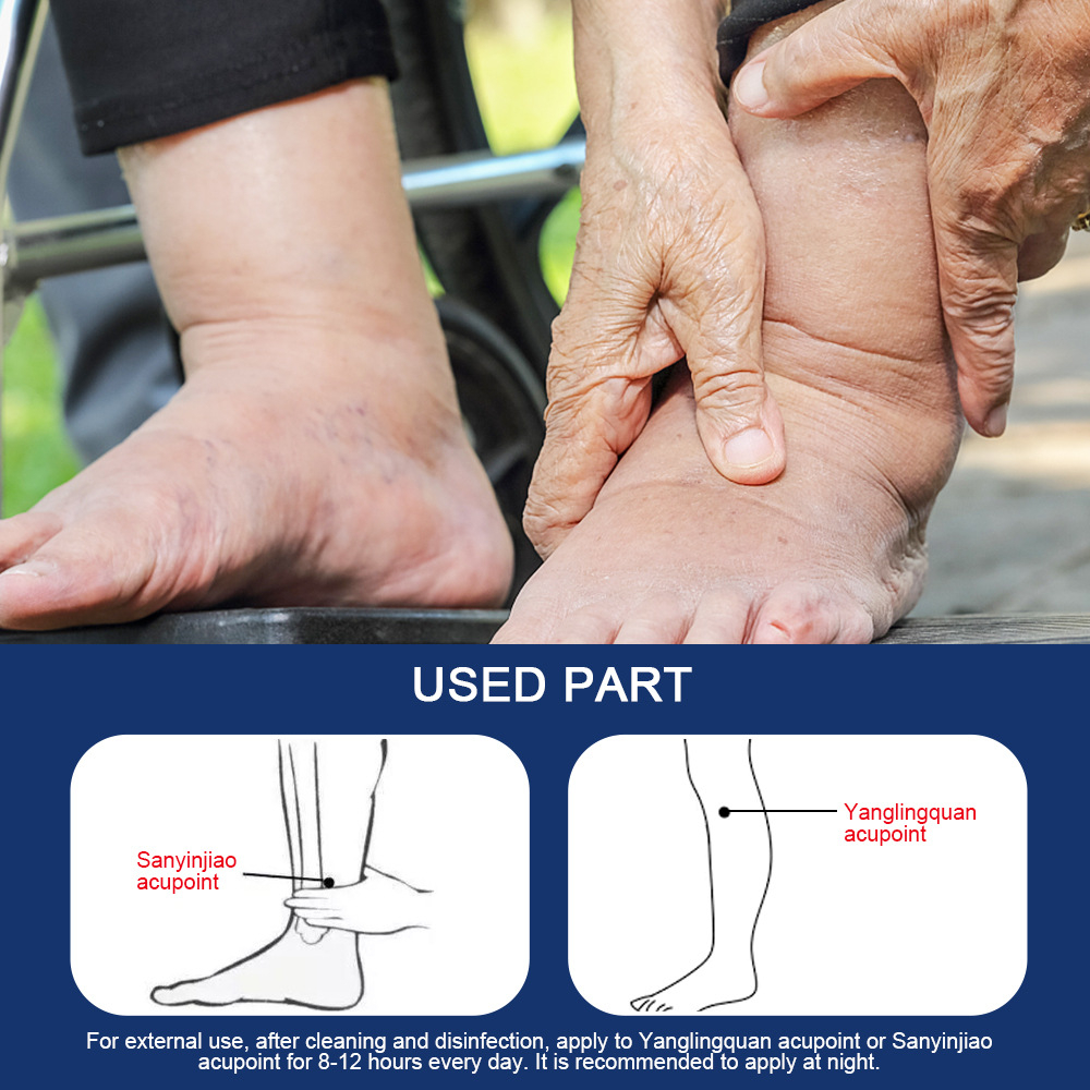 10pcs Edema Leg Relief Patch Remendo Para Inchaço E Cuidados Com Os Pés ...