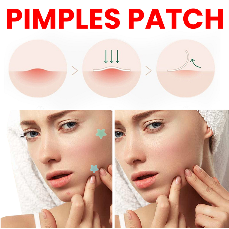 Patches Hidrocolóides Para Acne Com Hamamélis E Ácido Hialurônico ...