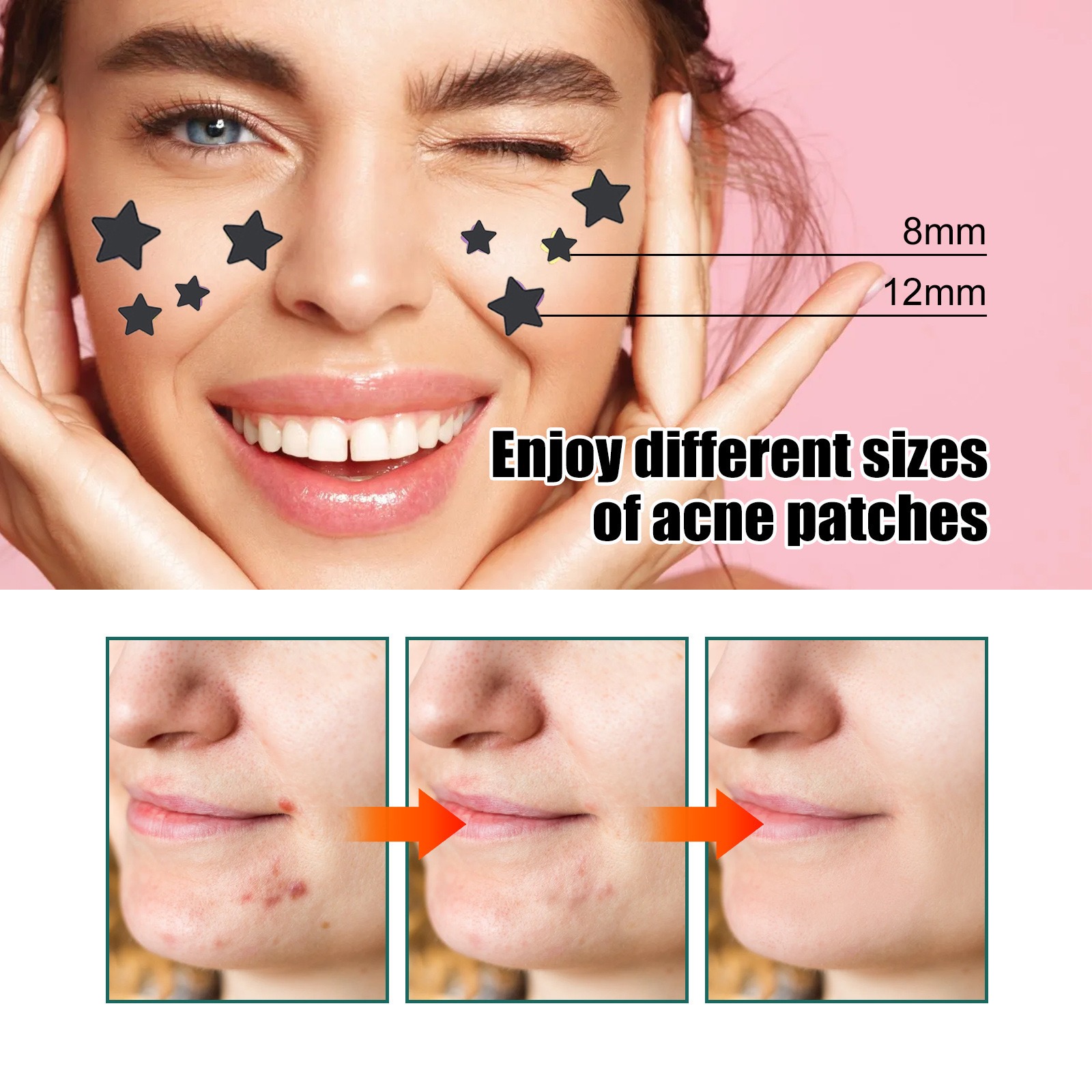 Star & Circle Acne Patches 640pcs - 7 Cores Adesivos Invisíveis, Design ...