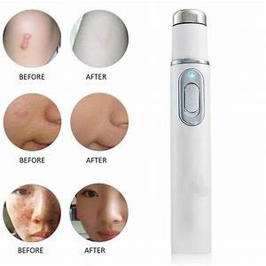 Caneta Laser Original Samlox Remove Manchas E Rugas Na Pele | Shopee Brasil
