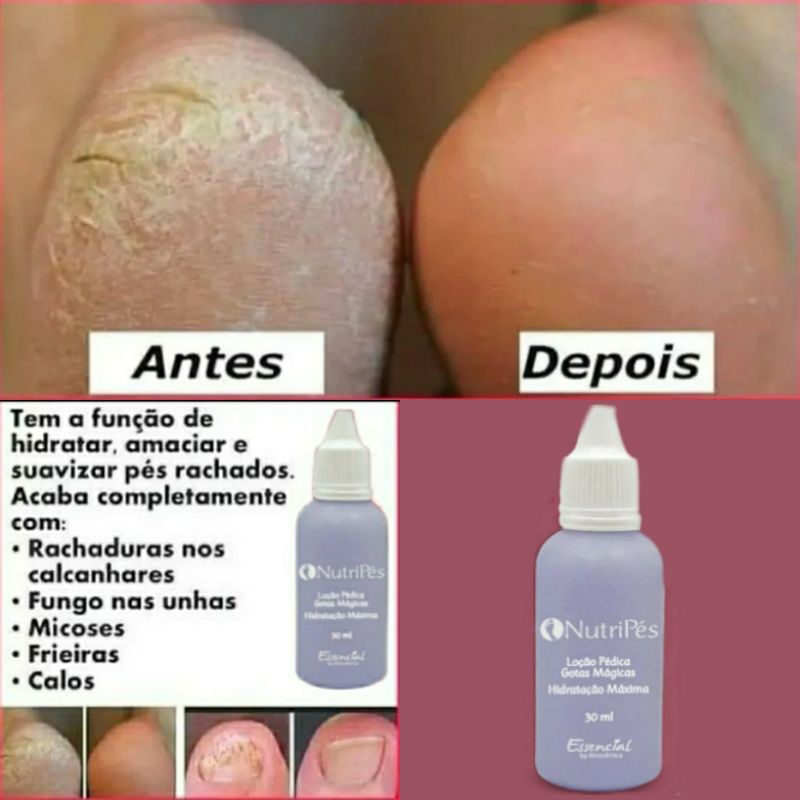 Gotas Mágicas Nutripés Loção Pédica Essencial by Hiroshima 30g | Shopee ...