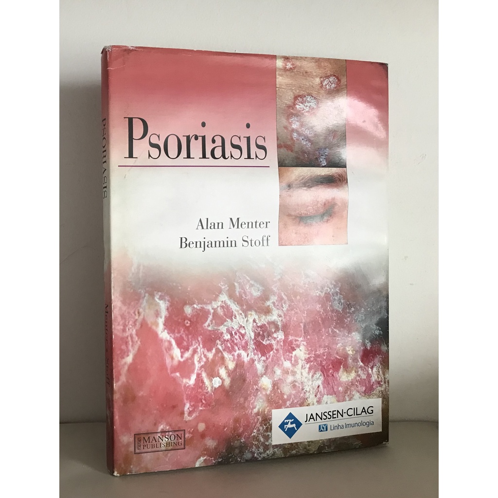 Livro: Psoriasis -- Alan Menter / Benjamin Stoff | Shopee Brasil