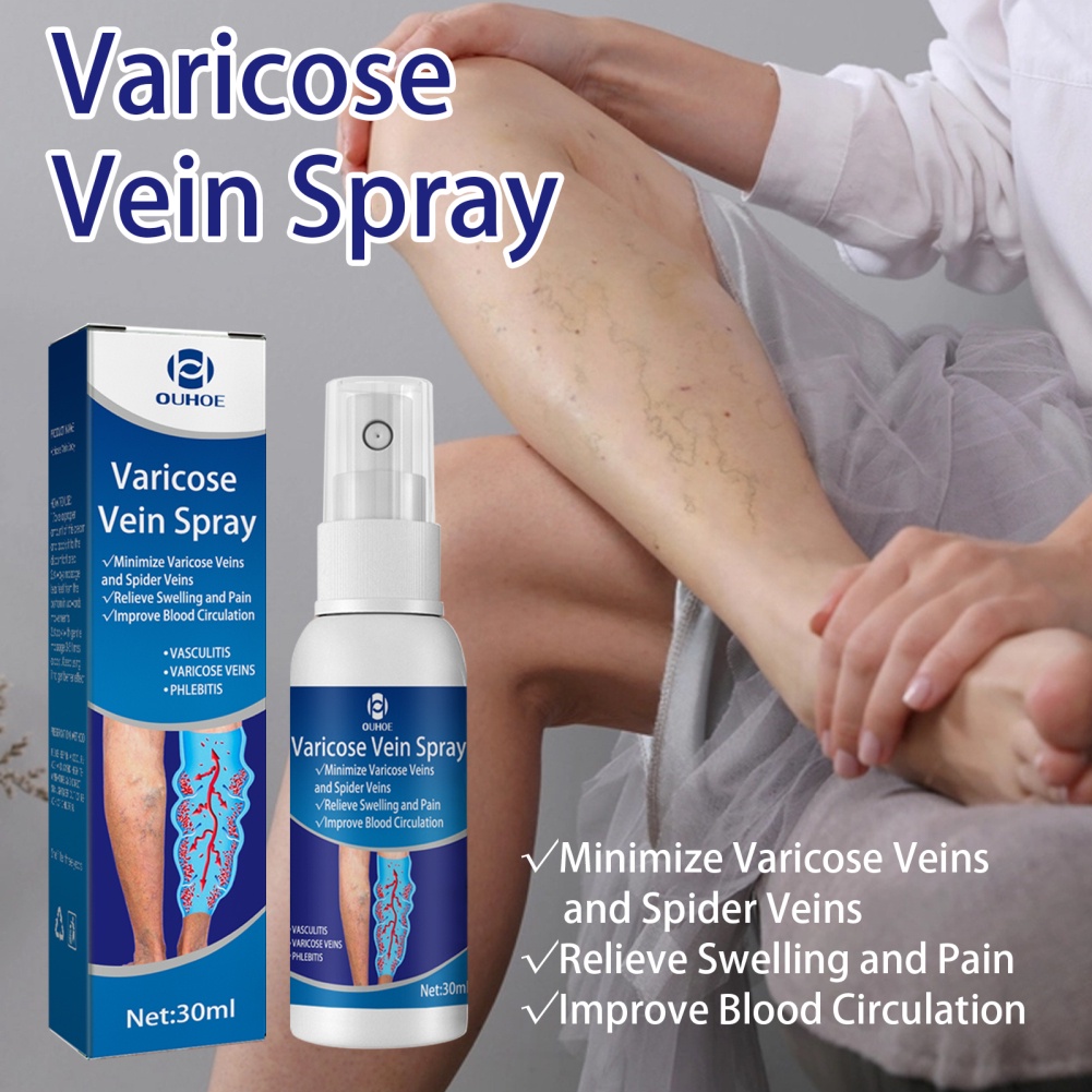 OUHOE spray De Massagem Para Varizes Aliviar Veias Venosas E Suavizar ...