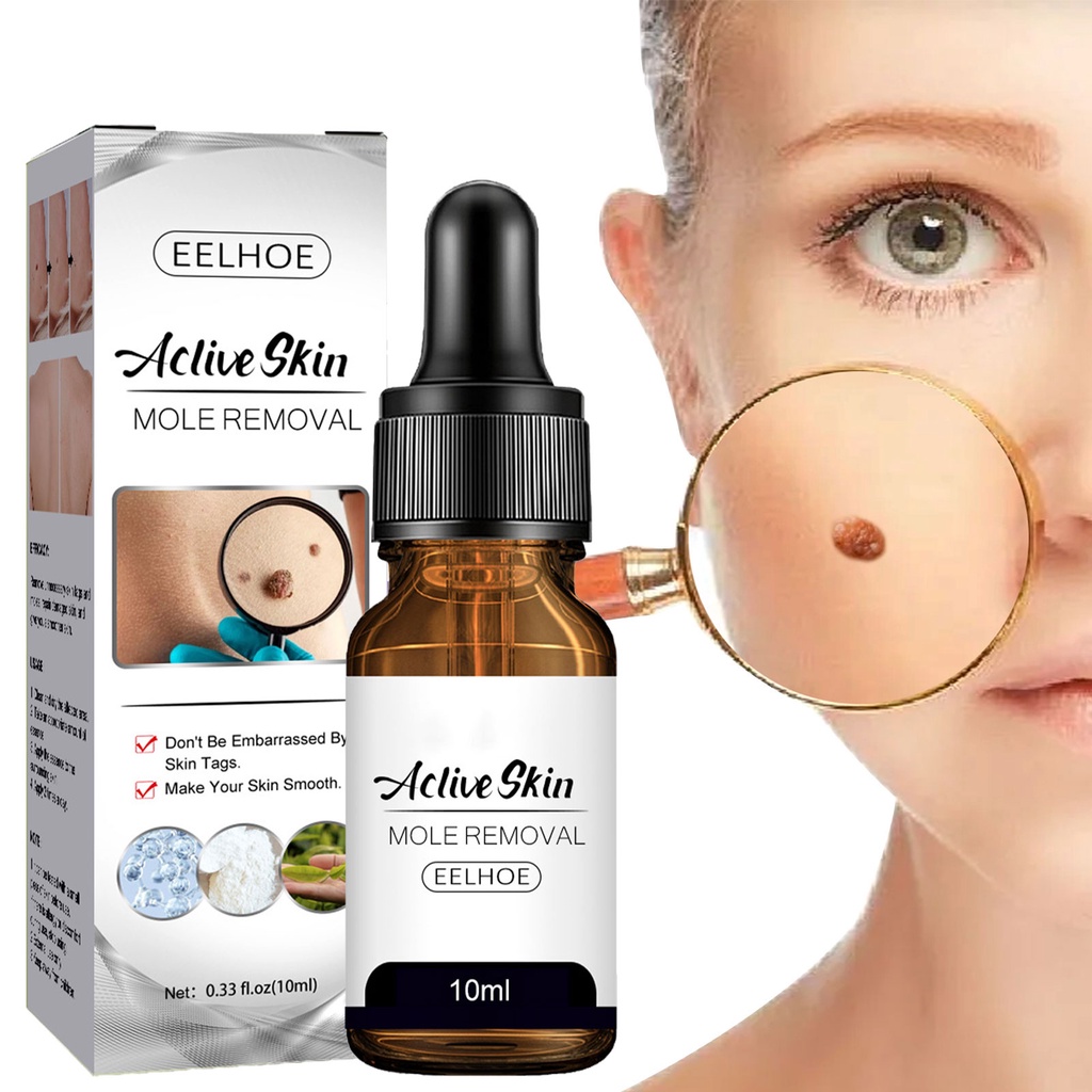 Belphoebe Plantar Wart Removedor De Verruga De Ação Rápida Líquido Pele ...