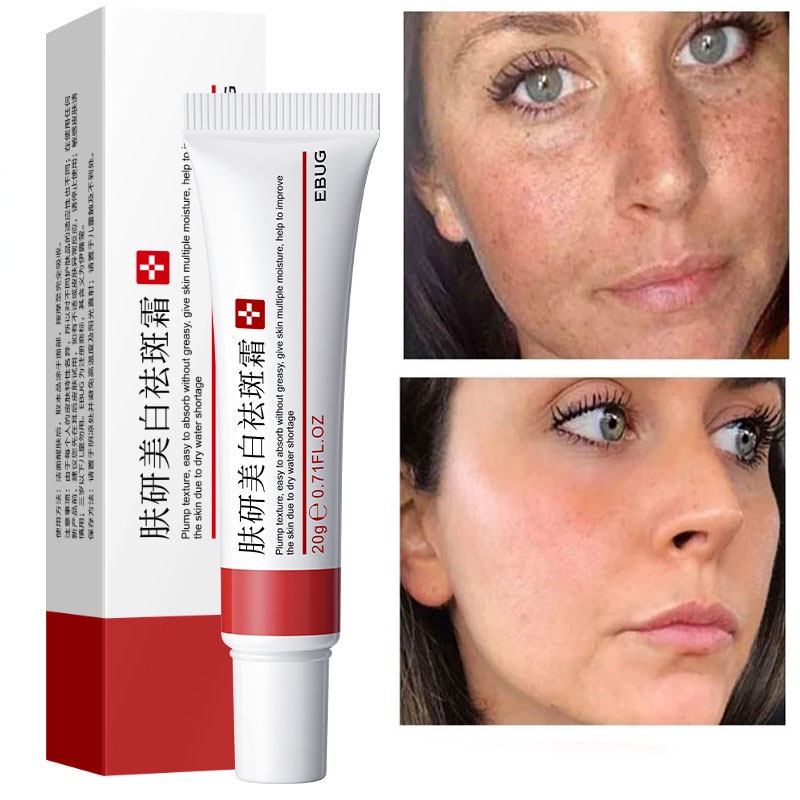 20g Creme Clareador Para Remover Melasma Remove Manchas Escuras Remove