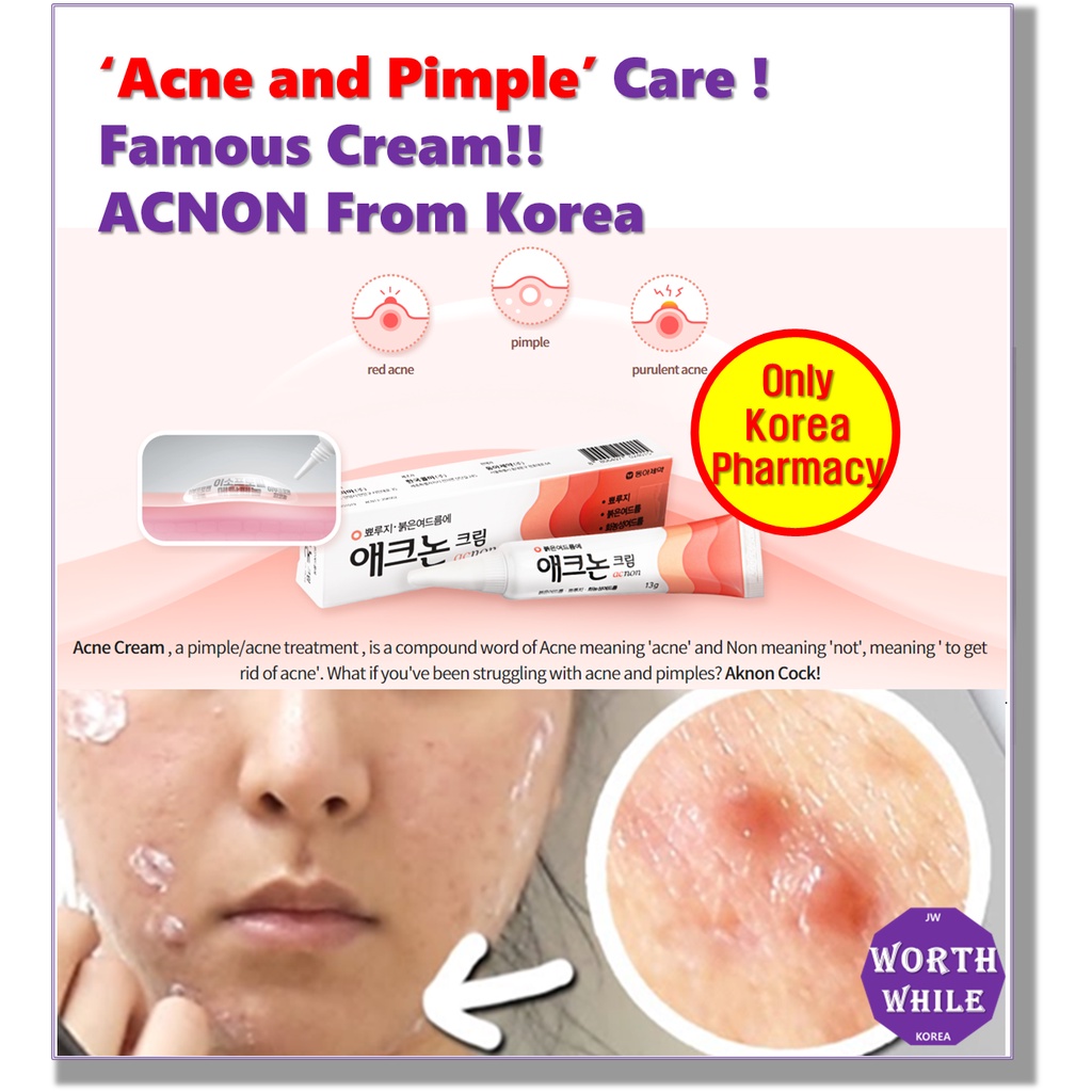 Acnon Cream 13g , Pomada Da Coréia/Removal De acnes E Espinhas/Cuidados Com Problemas De Pele ...