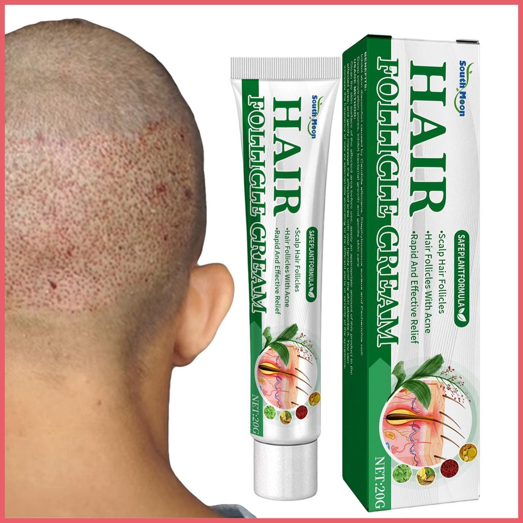 Foliculite Creme De Couro Cabeludo Tratamento De Ervas Pustules Úlceras ...