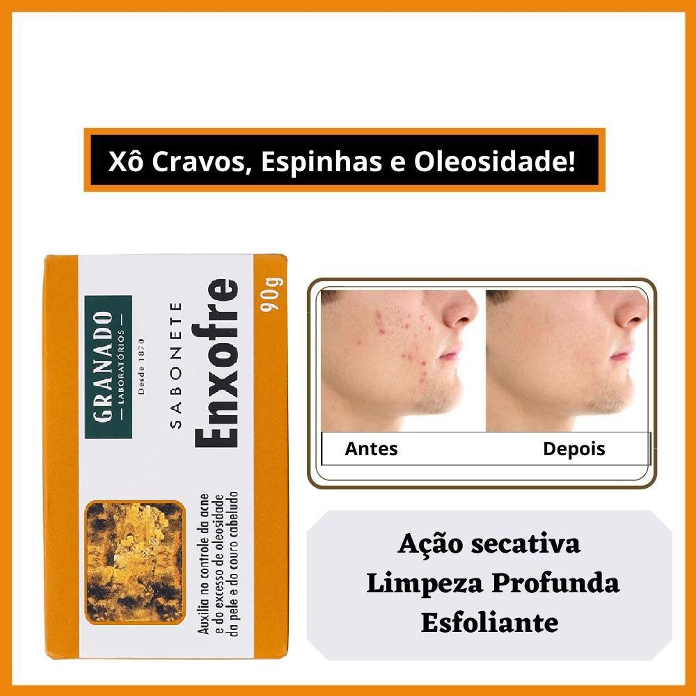 Sabonete Antiacne Pele Oleosa Cravos E Espinhas 90g | Shopee Brasil