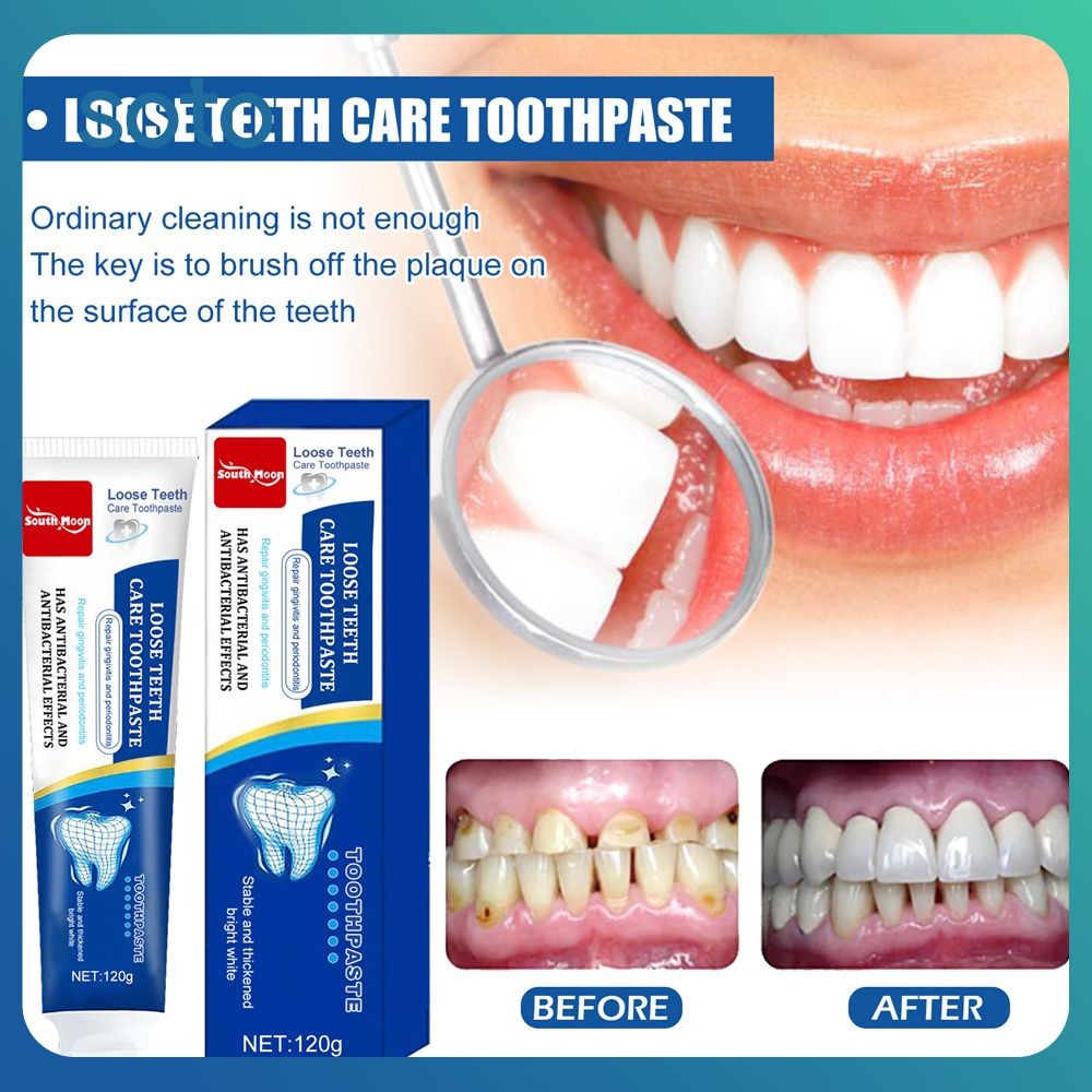 SOTO 1/3 Unidades De Pasta De Dente Removedora De Cálculo Dental Hálito ...