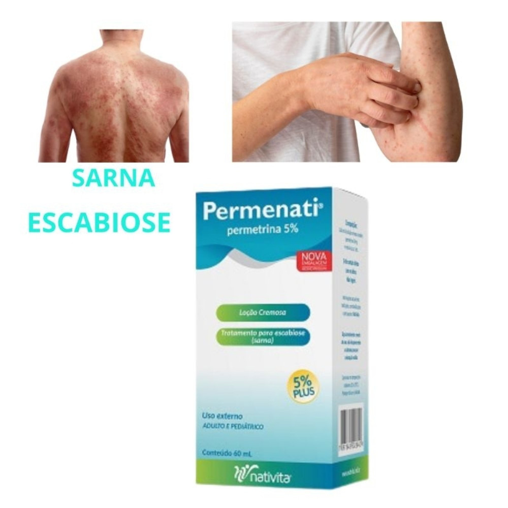 Permenati Permetrina 5% 60ml Nativita | Shopee Brasil