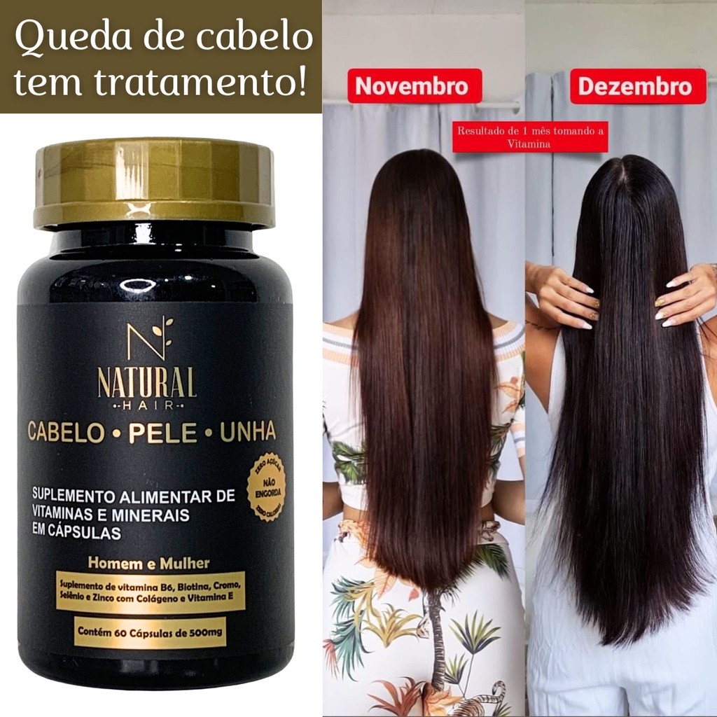 Vitamina Para Crescimento Capilar E Combate A Queda Natural Hair Caps ...