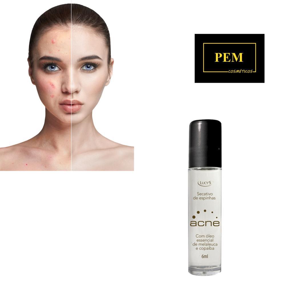 Secativo Acne Roll-on Cicatrizante Antisséptico | Shopee Brasil