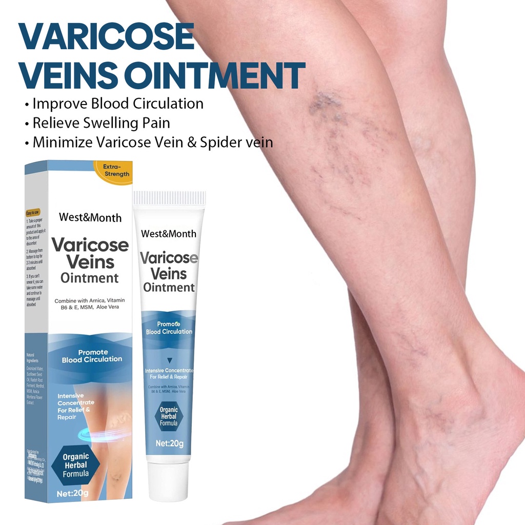 ONCHENDI 20g Creme De Tratamento De Varizes Para Pernas Eliminar ...