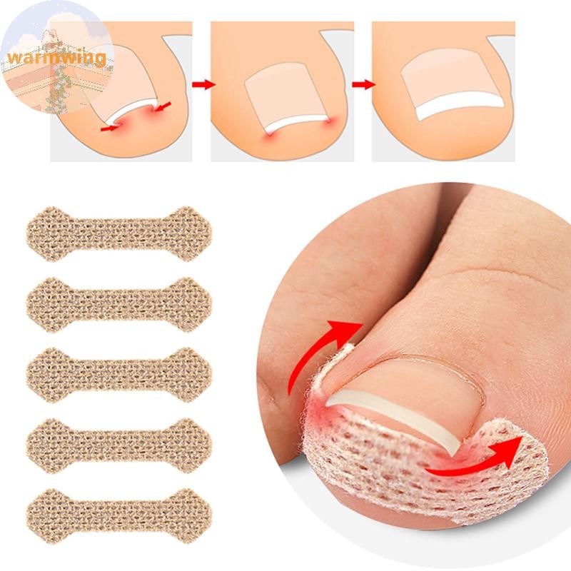 Warmwing 4/10 Folhas Pedicure Ferramenta De Unhas Encravadas Adesivos Para Corretor Paroníquia ...
