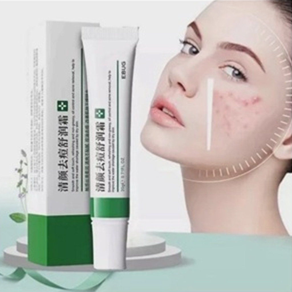 Pomada Para Retirar Acnes Manchas Espinhas Hidrata E Melhora A Pele 20g | Shopee Brasil