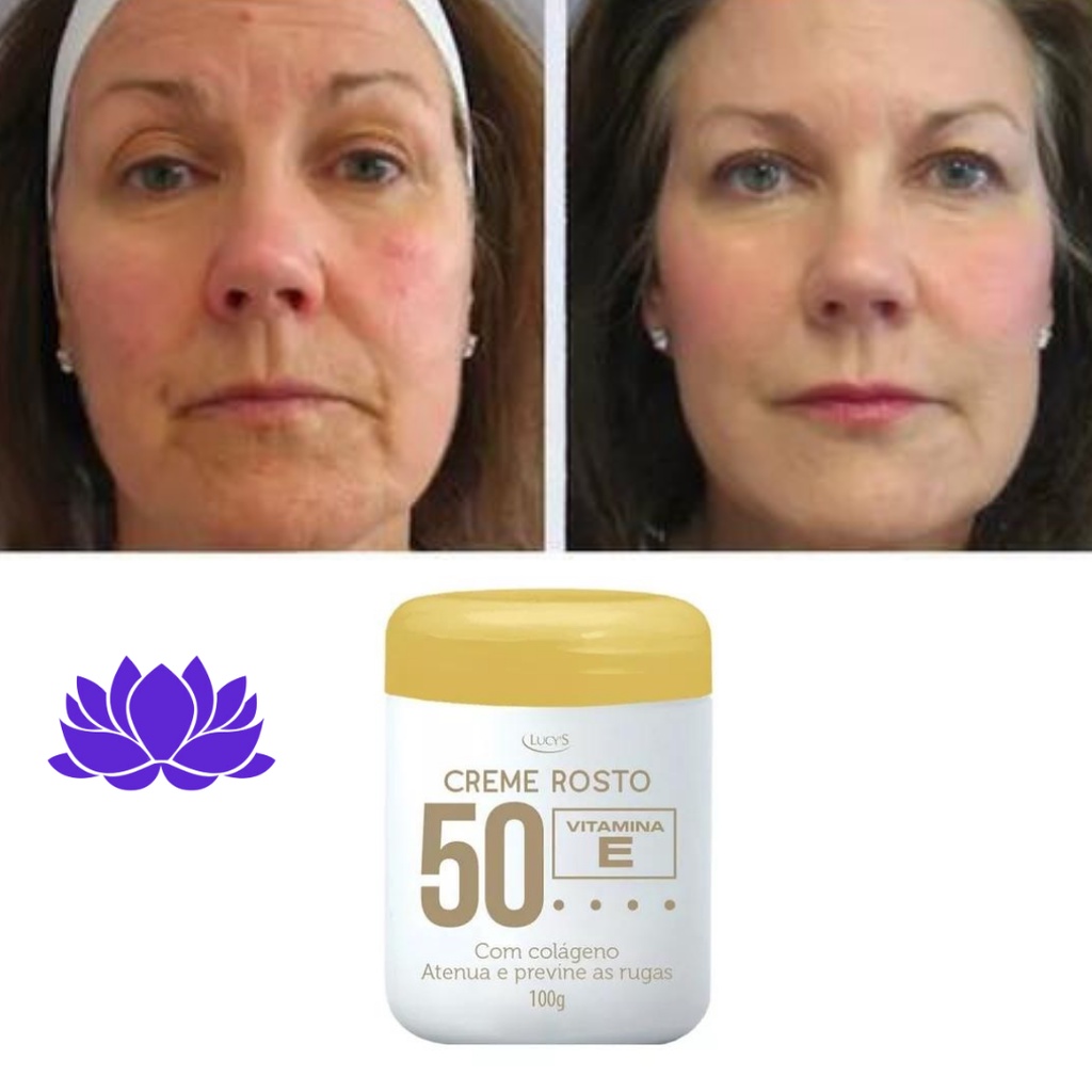 Cremes Anti Rugas Com Colágeno Sinais Profundos 50+ Anos | Shopee Brasil