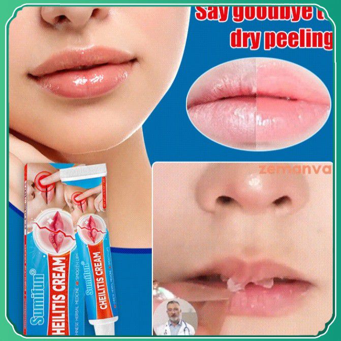 HOM Sumifun Cheilitis Balm Lip Care Creme Externo Para A Pele | Shopee ...