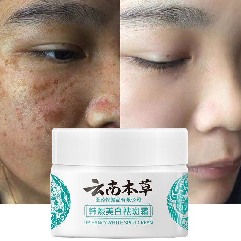 Yunnan fitoterápico pomada forte lixívia de ervas para remover manchas ...