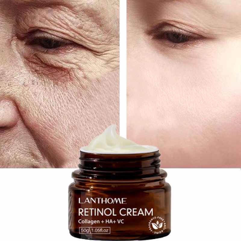 Creme Retinol Para Rosto Anti Idade Hidratante Rugas Clareamento ...