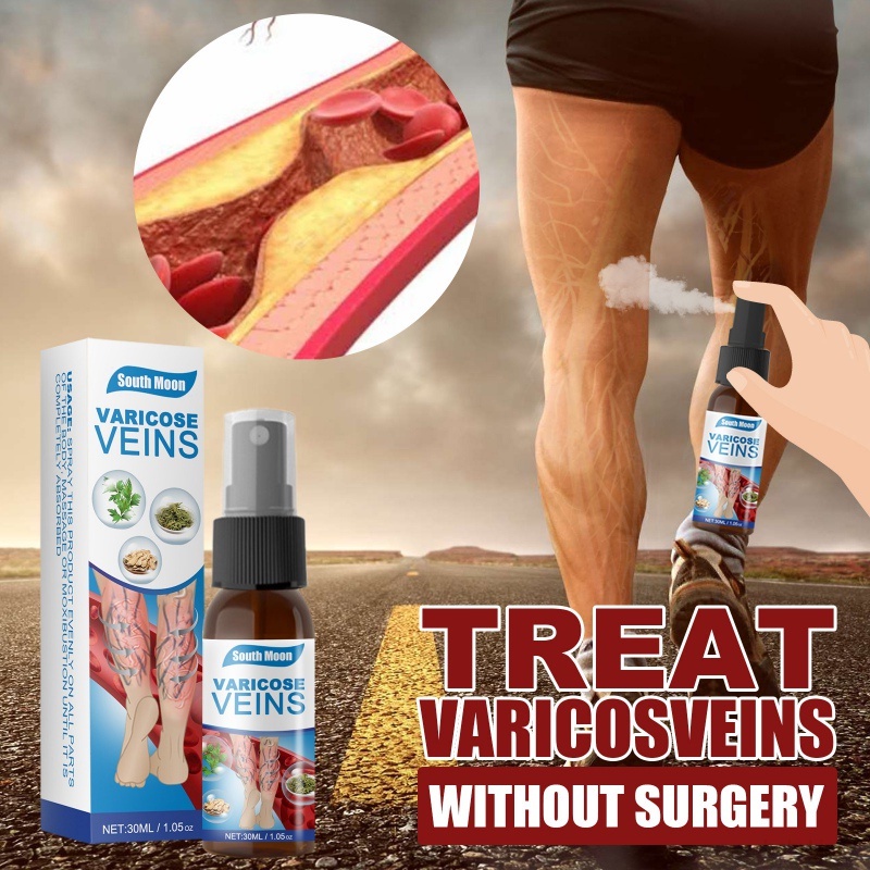 Spray De Varizes Para Cuidados Com As Pernas Óleo Essencial O Corpo ...