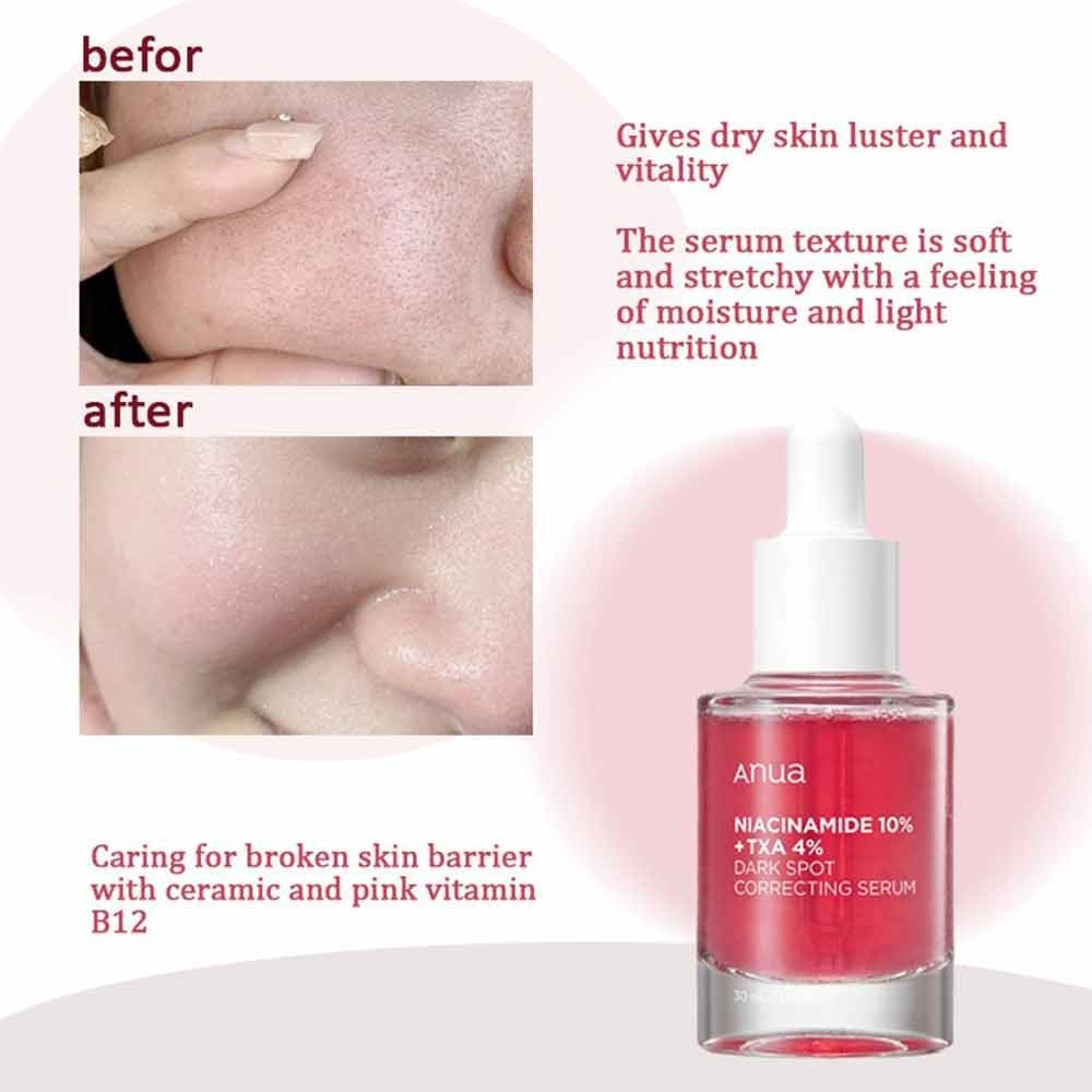 30ML Anua Dark Spot Correction Serum Brighter Complexion and Even Skin ...