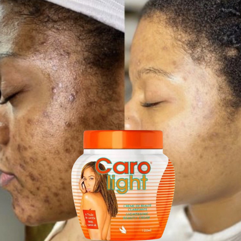 Creme Clareador de Manchas Caro Light : Original Clareia a Pele e ...