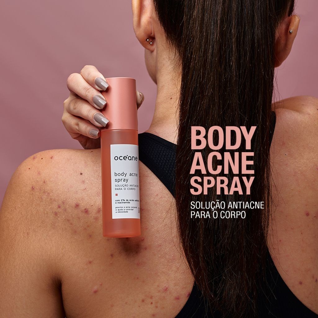 Solução Antiacne Para o Corpo - Body Acne Spray 100ml | Shopee Brasil