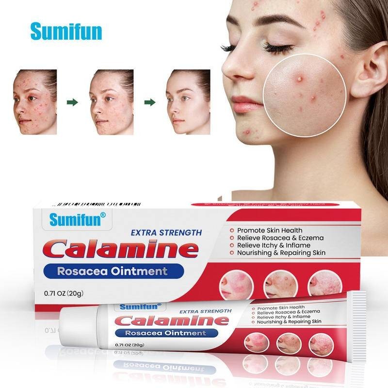 20g De Calamina Rosacea Extra Forte Pomada Reparação Da Acne Creme ...