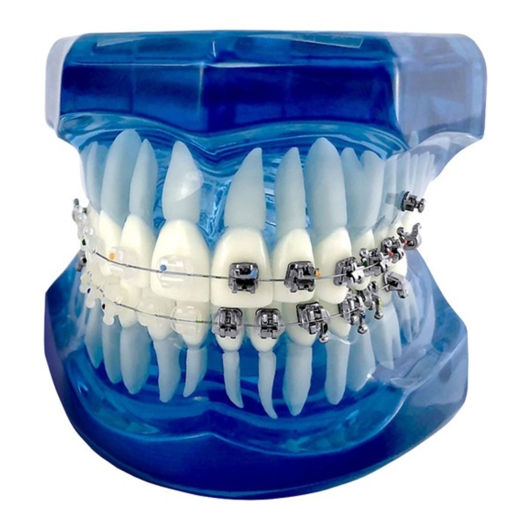 Manequim Didático Ortodôntico - Morelli | Shopee Brasil