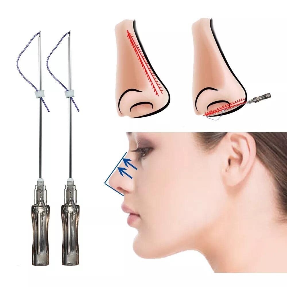 Pdo Nose Cog Threads 19G38MM 19G60MM Pdo Cog Threads para Nose Columella Nossa ponte para Dorsum ...