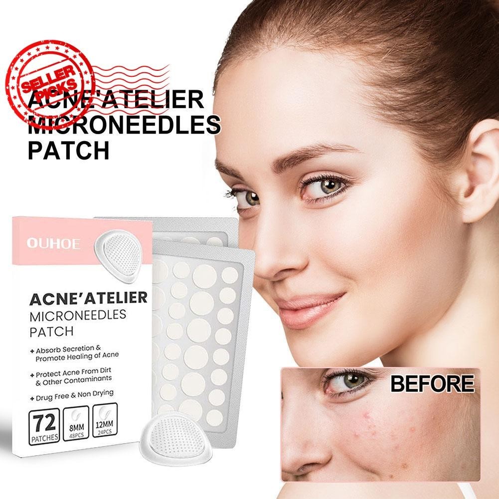 Patch Acne Microneedle Remoção De Cuidados Faciais S4s0 | Shopee Brasil