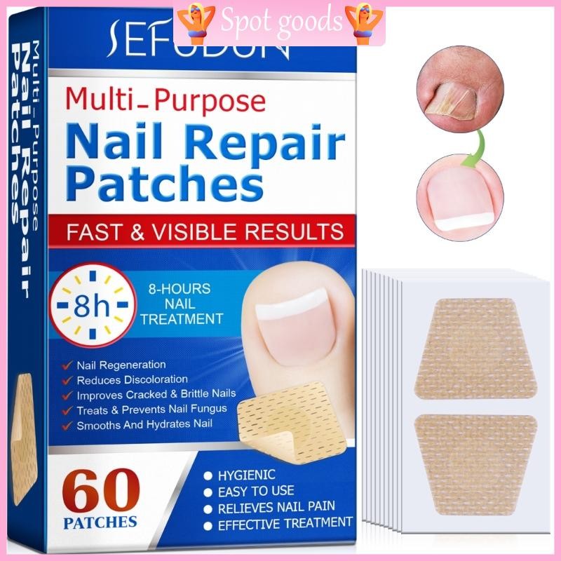 Vavavava Renewal Plasters Stickers Adesivos Renovação Unhas Encravadas ...