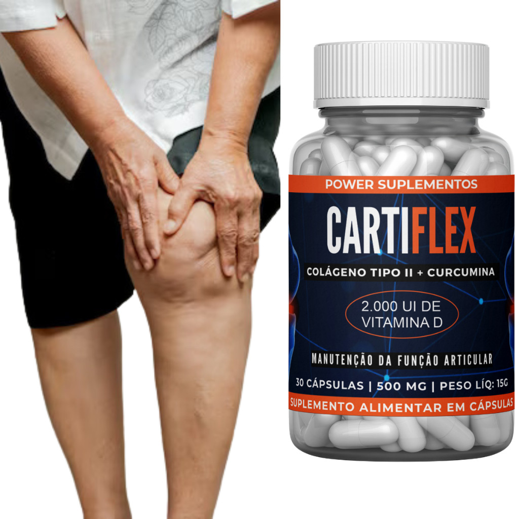 1 Pote Cartiflex Colágeno Tipo 2 + Curcumina 30 Caps | Shopee Brasil