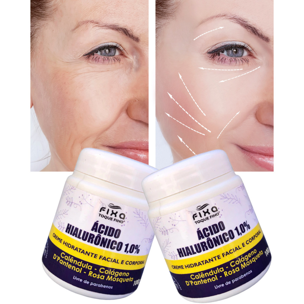 Creme ácido Hialurônico Anti Rugas Colágeno E Rosa Mosqueta100g