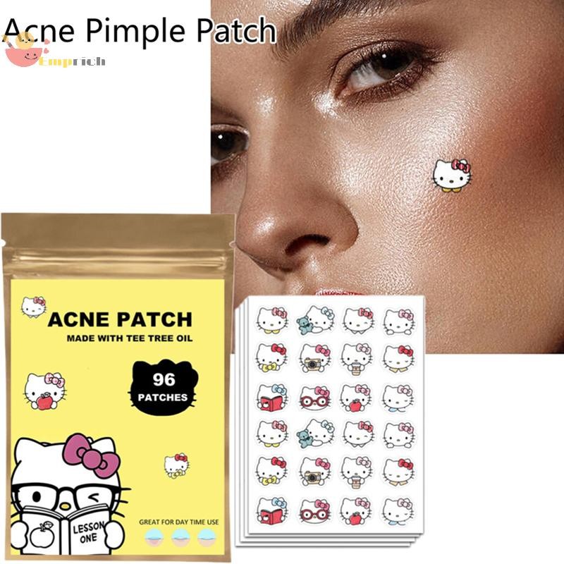 EMCH > 96 Peças Hello Kitty Cat Repair Acne Patch Cuidados Com A Pele ...
