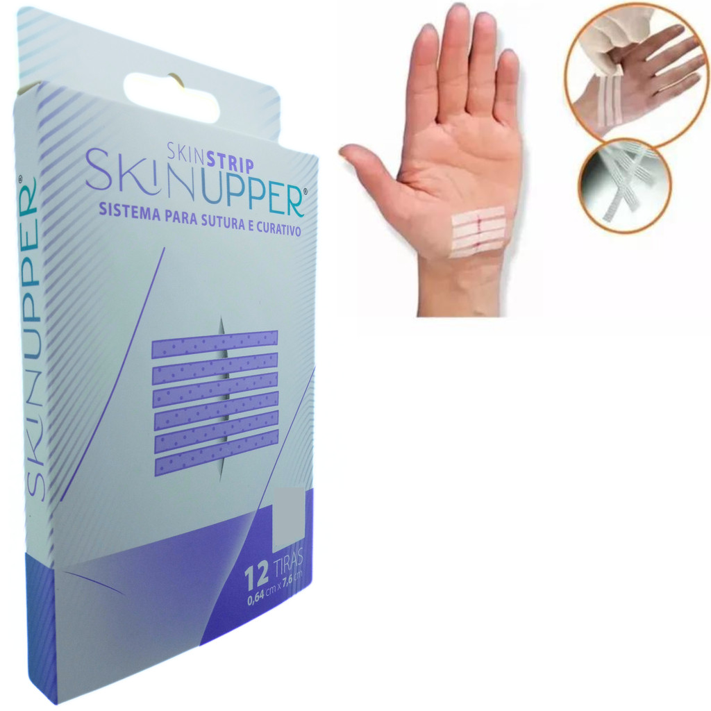 Ponto Falso Para Corte Na Mão Perna Corpo Pele 2 Envelopes 6 Com Tiras ...
