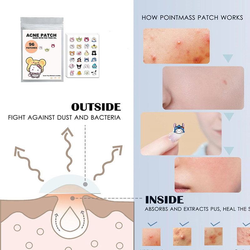 TUTU 96 Peças Hello Kitty Cat Repair Acne Patch Cuidados Com A Pele ...