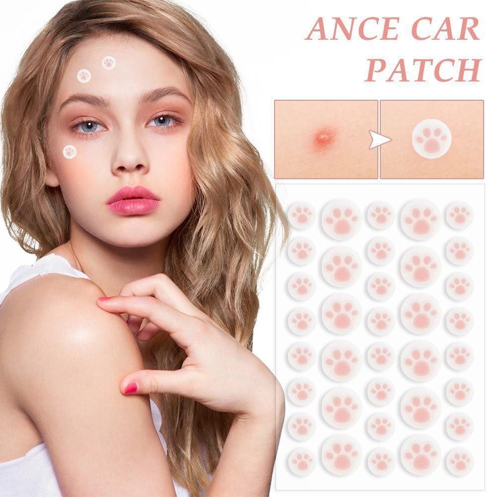 Pink Acne Patch Suave e Não Irritante Dessalting PIMPLE Acne Boca ...