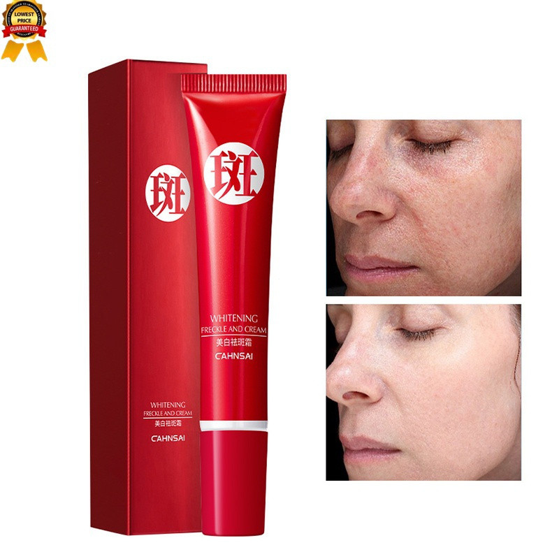 Creme Original Anti-Rugas Clareador Poderoso Remove Manchas de Idade ...