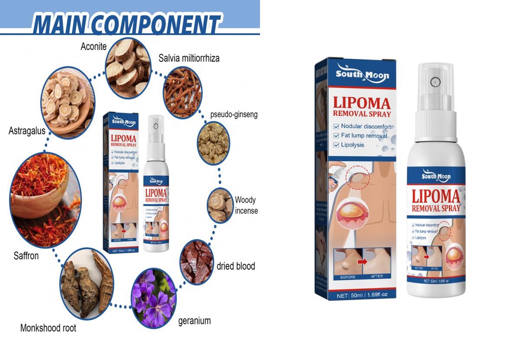 [SK] 50ml Fatty Lump Spray Skin Care Safe Body Lipoma Removal Liquid ...
