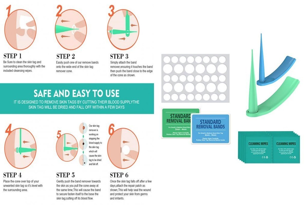 Skin Tag Removal Tool Ligation Method Remover Kit Easy Effective for ...