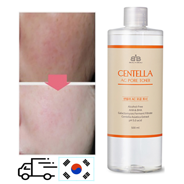 Centella AC Toner De Poros 500ml | Shopee Brasil