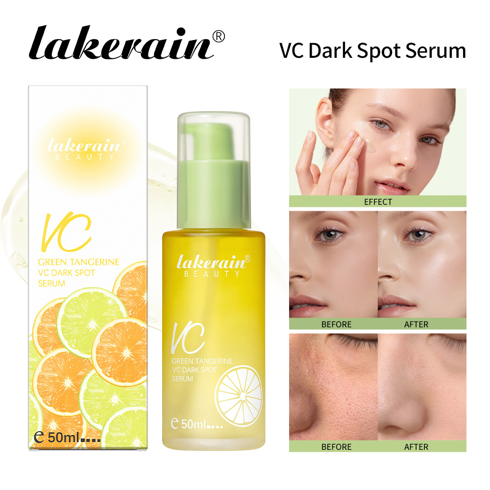 Lakerain 50ml Vitamina C Soro Clareador De Manchas Escuras Da Pele Facial | Shopee Brasil