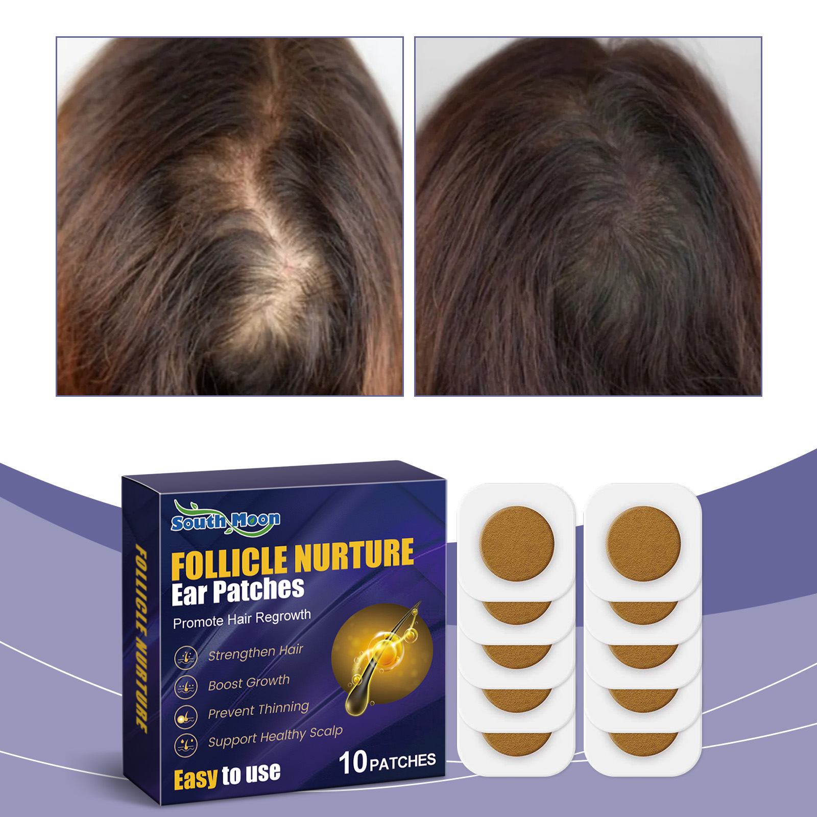 South Moon Hair Follicle Nourish Patch promove o crescimento do cabelo, previne a alopecia e ...